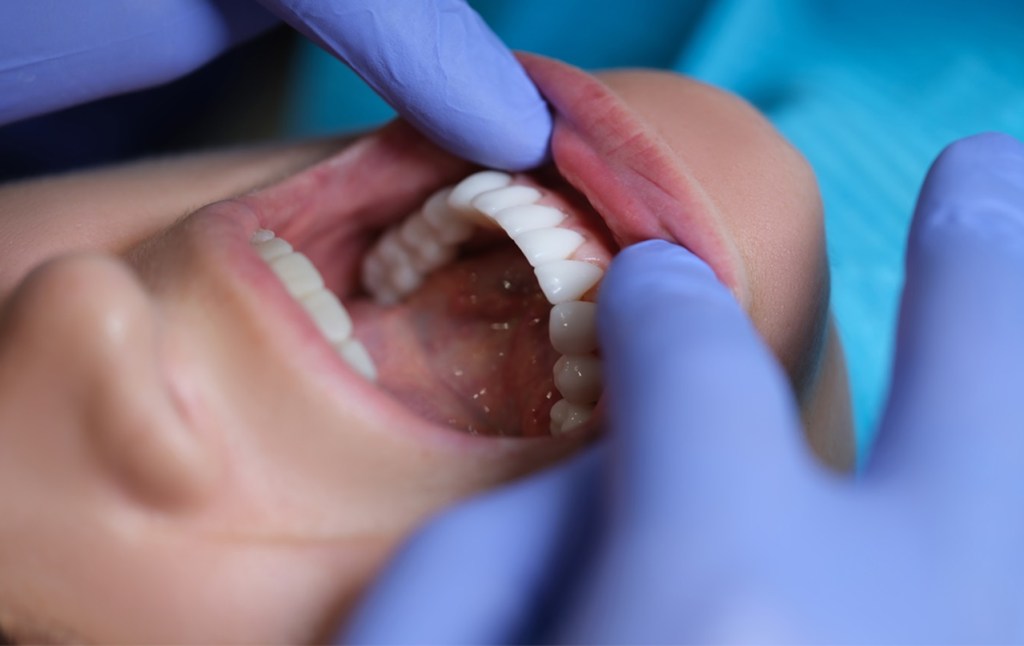 April Is Oral Cancer Awareness Month April Is Oral Cancer Awareness Month